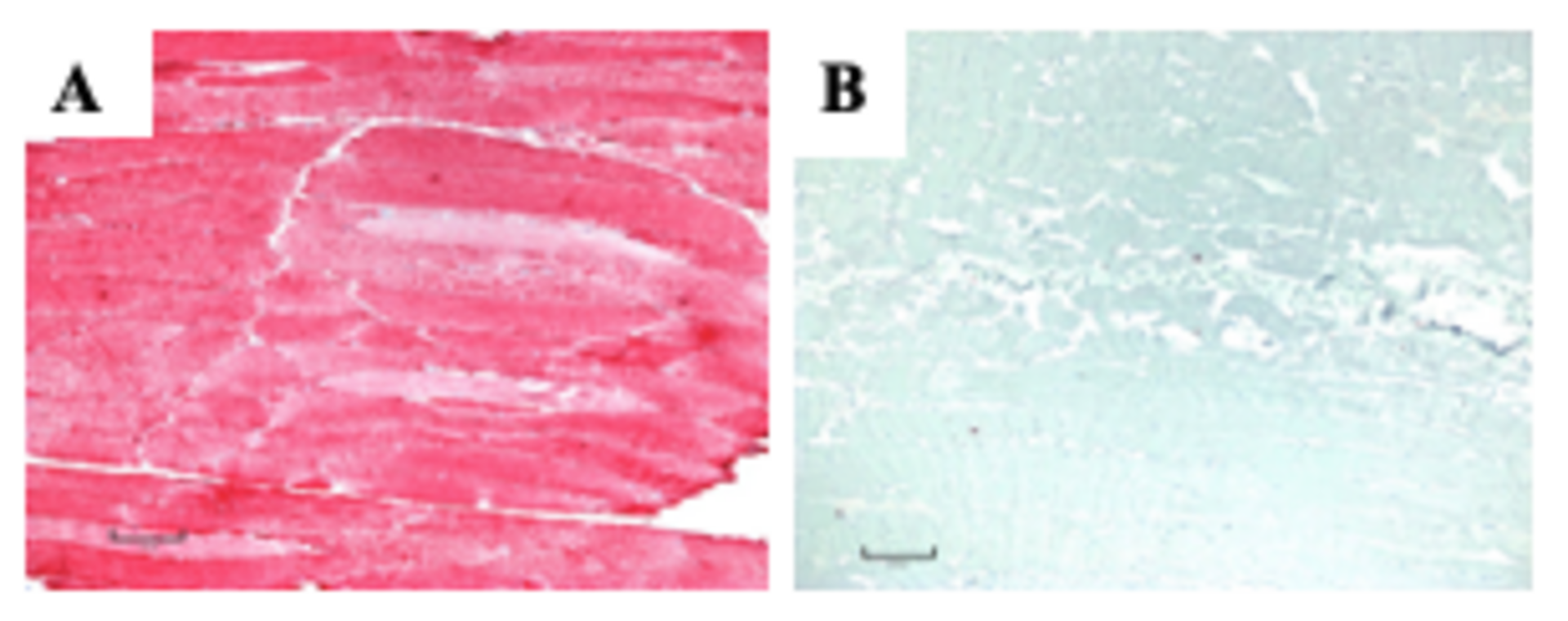 Nebraska team identifies new genetic defect impacting cattle morbidity ...
